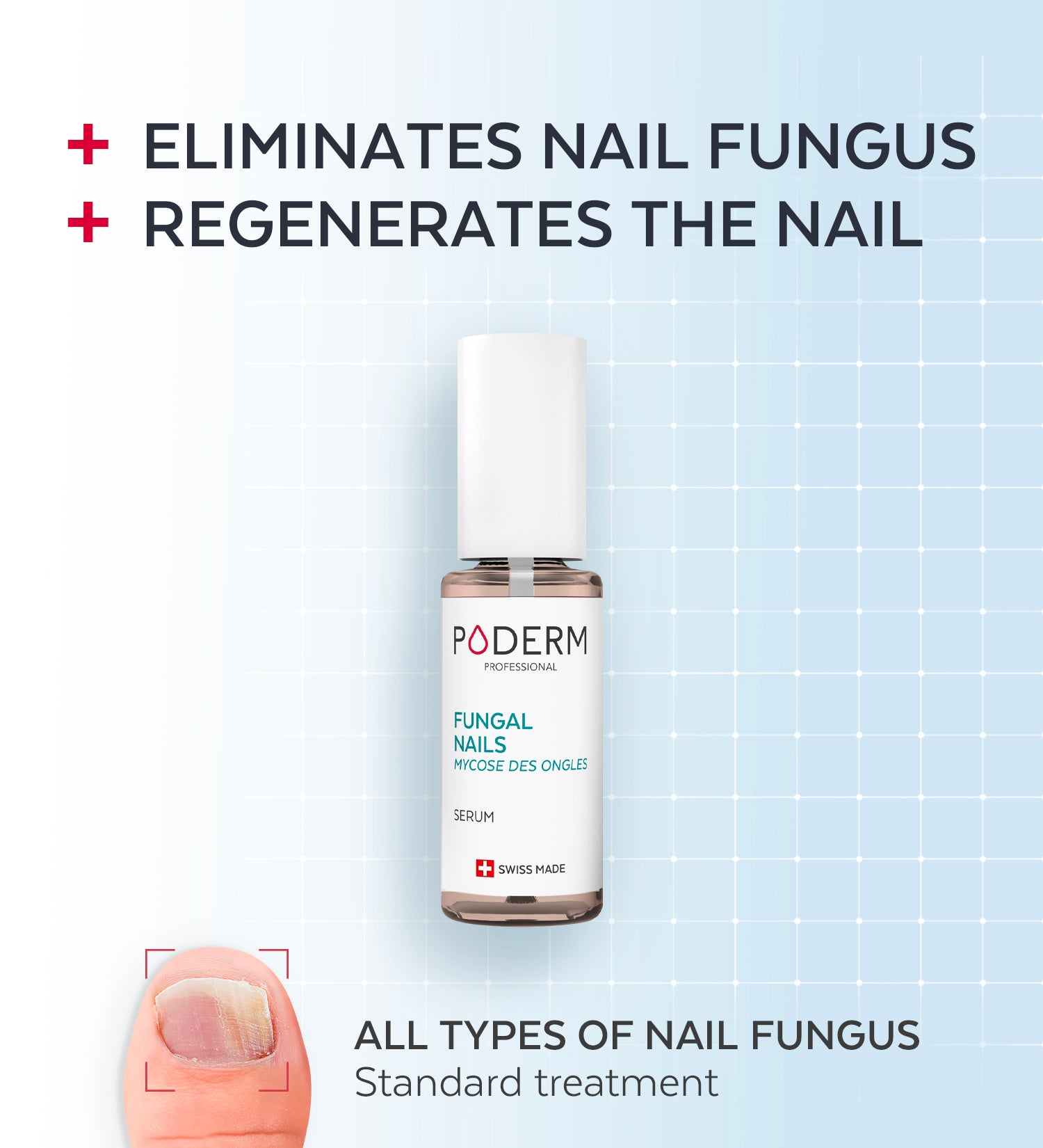 Fungal Nails Serum: effective treatment | Poderm® – PODERM®