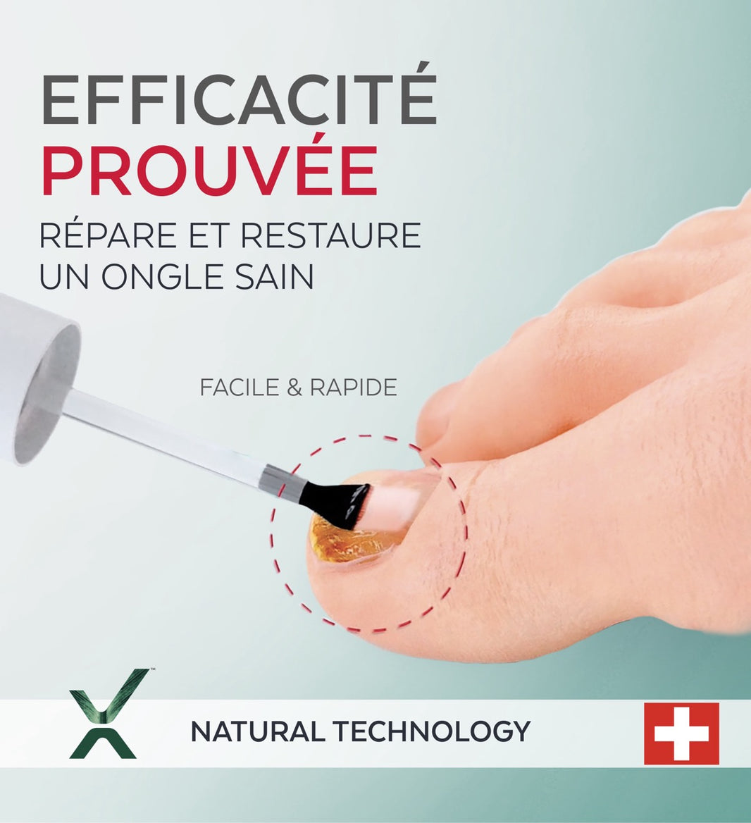 Mycose de l’ongle : comment la soigner ? - PODERM – PODERM®